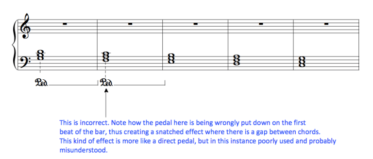 pedal markings – The Cross-Eyed Pianist